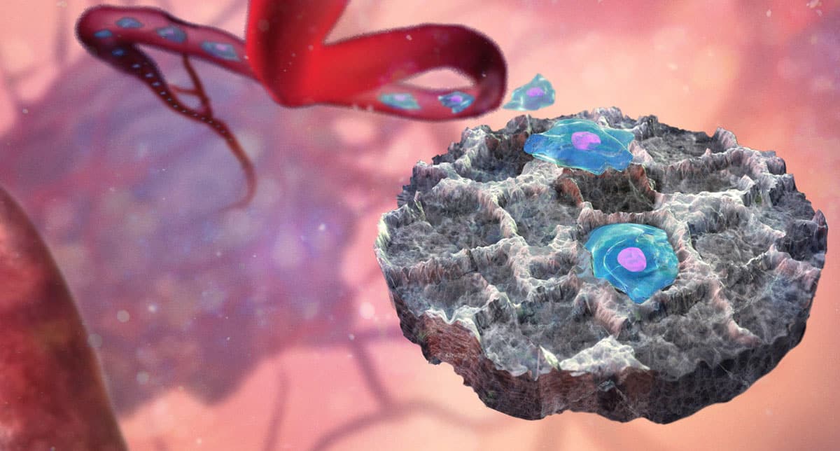 Dispositif minuscule qui attire les cellules cancéreuses pour le ...